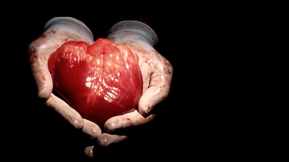 How the future of treating heart disease might mean having no heartbeat ...